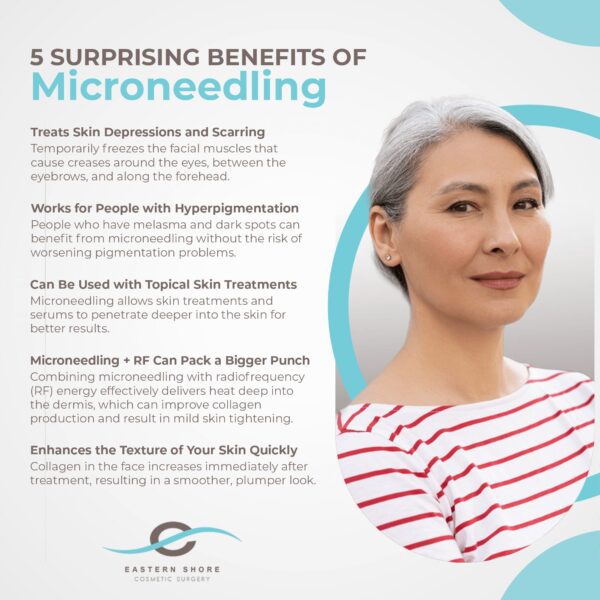 5 Surprising Benefits of Microneedling