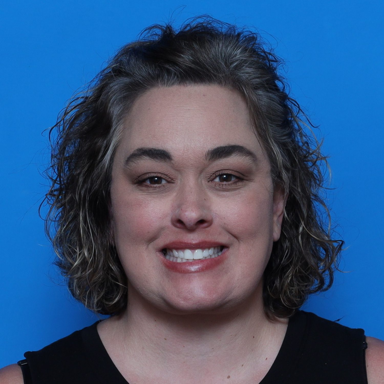 Alabama Facelift Patient Photo Case 10796
