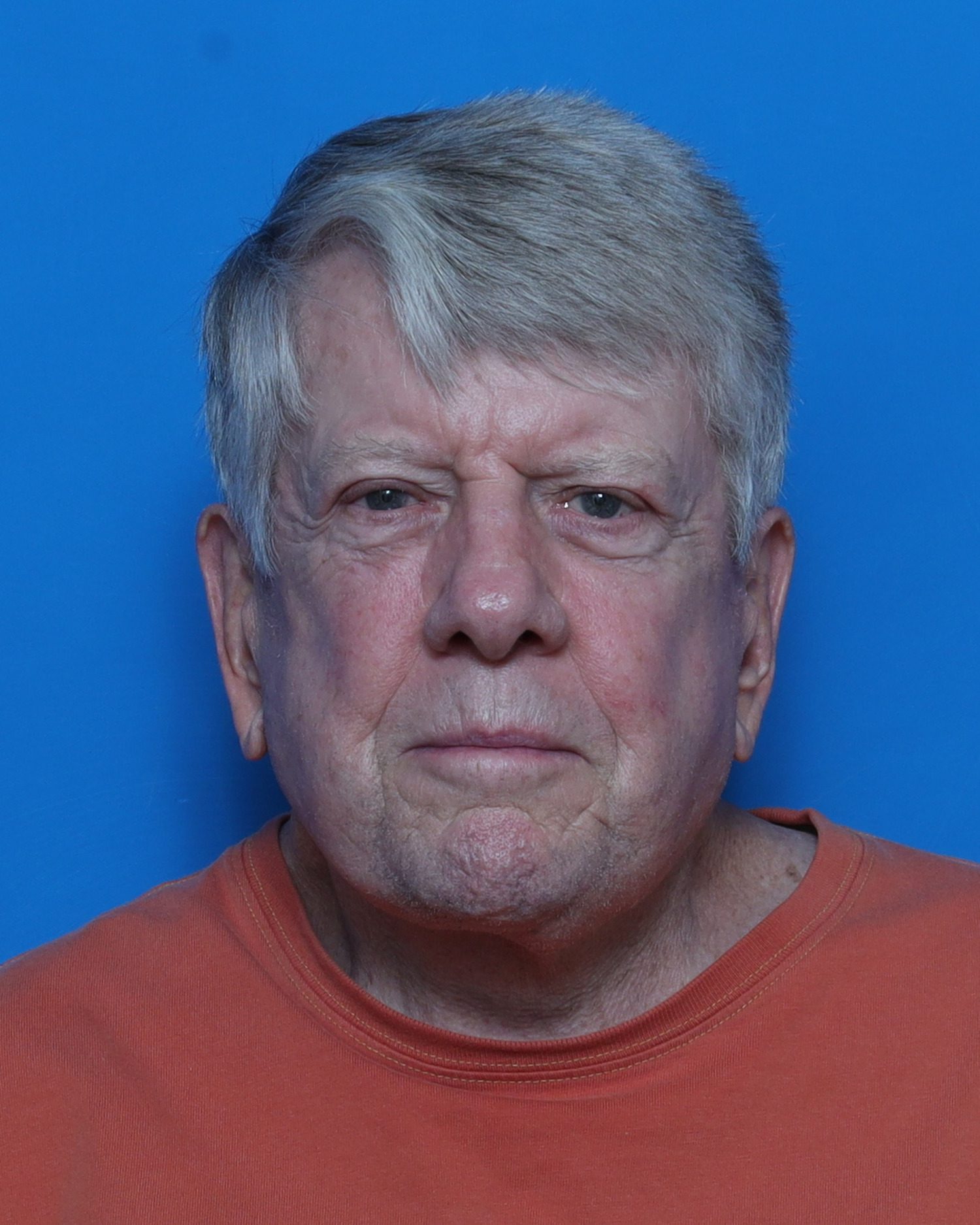 Alabama Facelift Patient Photo Case 10991